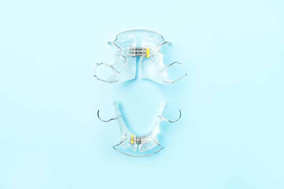 How Long Should You Wear Your Retainer?